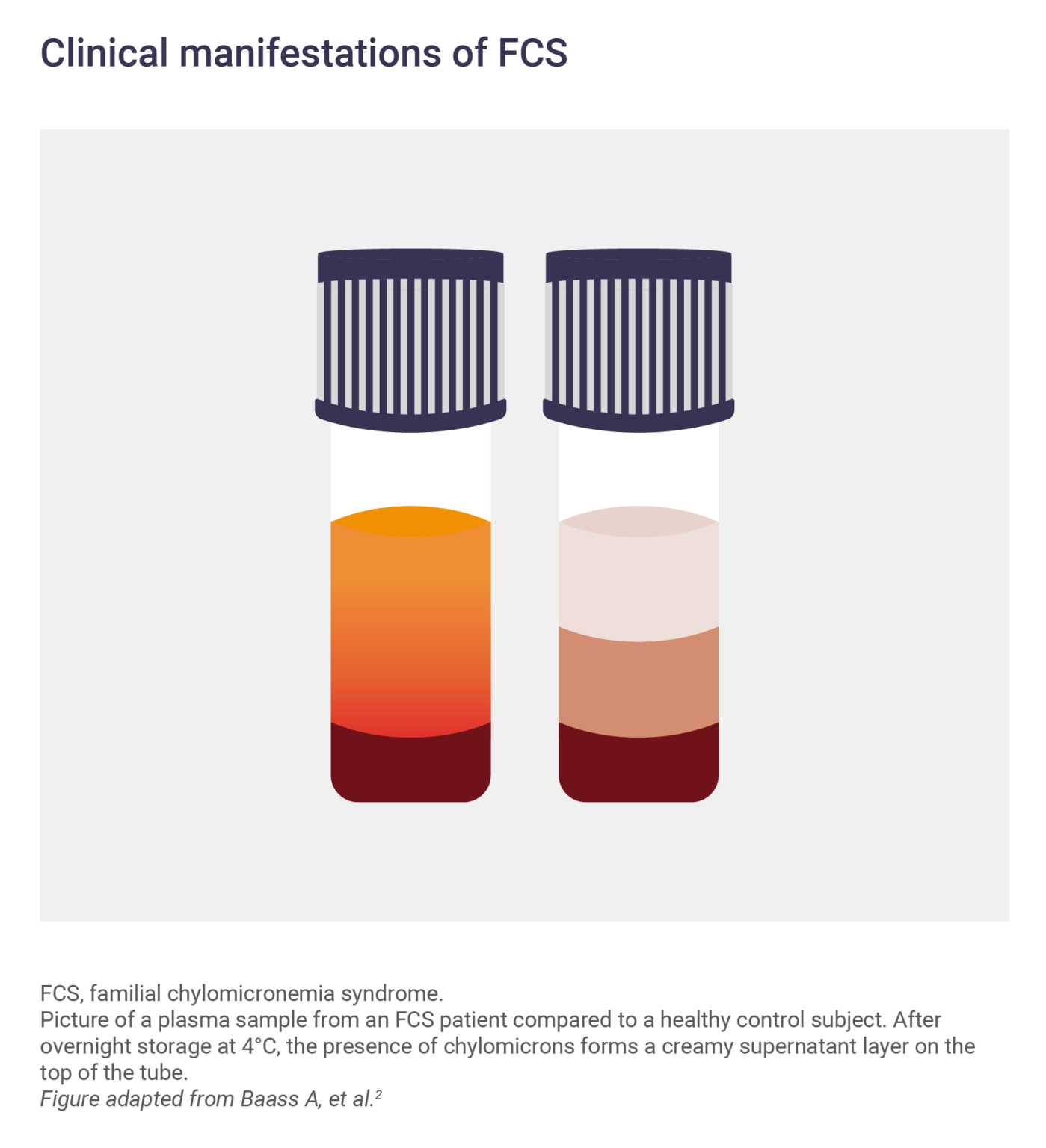 Familial chylomicronemia syndrome (FCS) disease overview - MEDhub