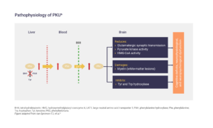 PKU disease overview - MEDhub